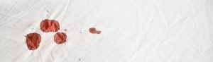 How to Get Blood Out of Bed Sheets [Guide]